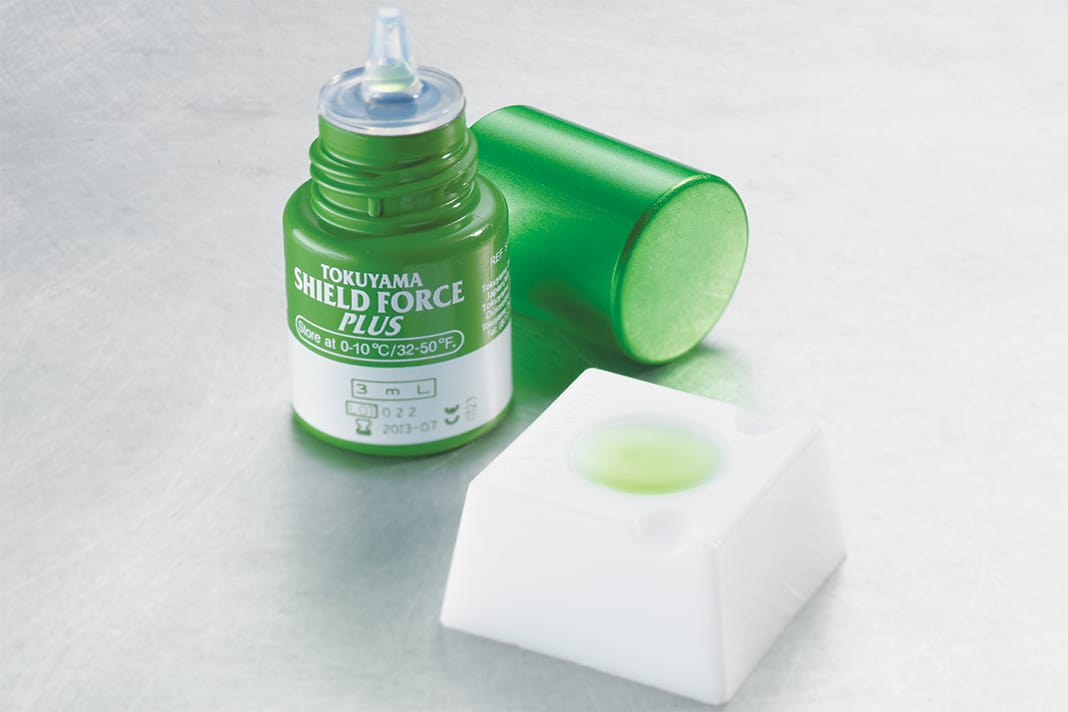 Trismus: A Potential Complication of Administering Local Anesthesia ...