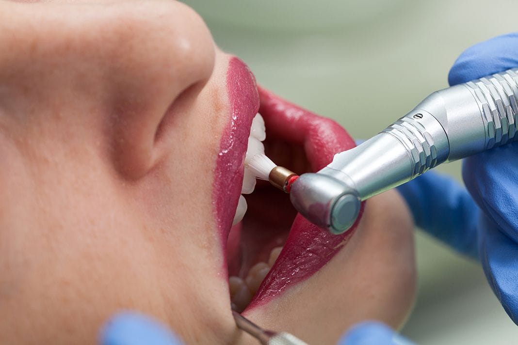 Polishing: Are You Spinning in Circles or Ready to Ride the Wave ...