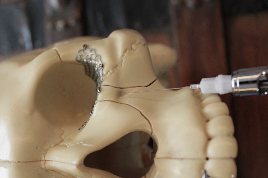 IO-My! Getting the Perfect Anesthesia Injection - Today's RDH