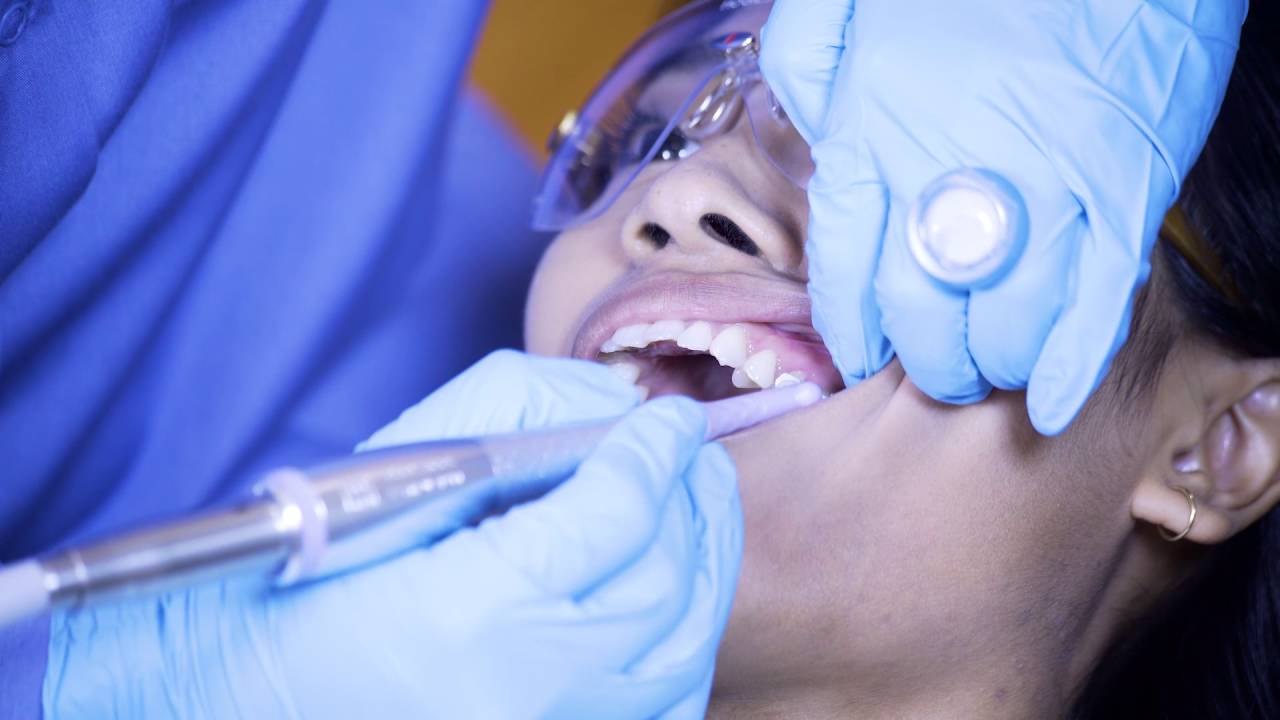 VIDEO: Nupro Revolv Slim Disposable Prophy Angles - Today's RDH