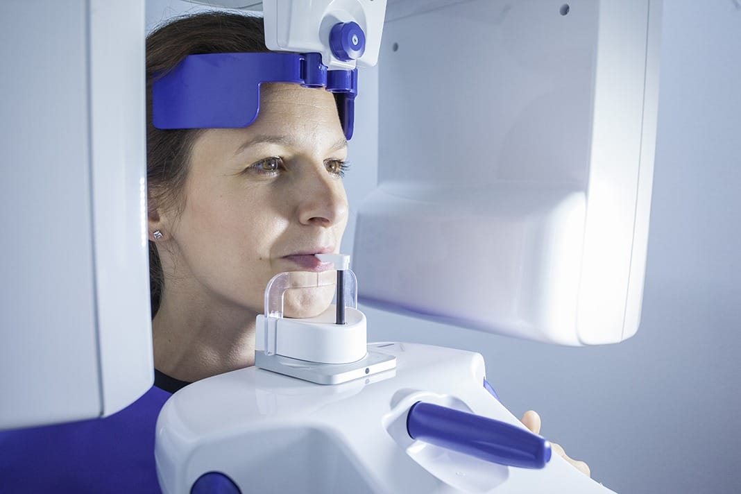 Setting Dental Xray Exposure Setting Proper Dental X A Complete Guide