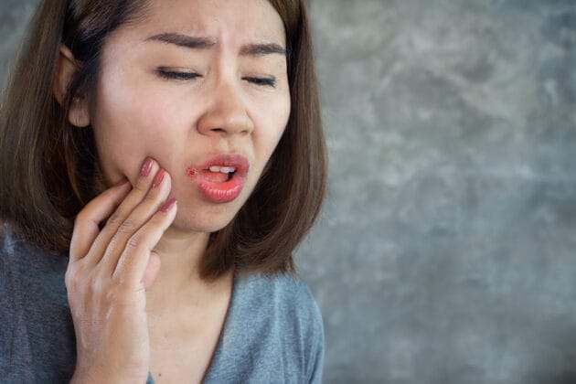Stomatitis: How Dental Professionals Treat and Manage these Conditions ...