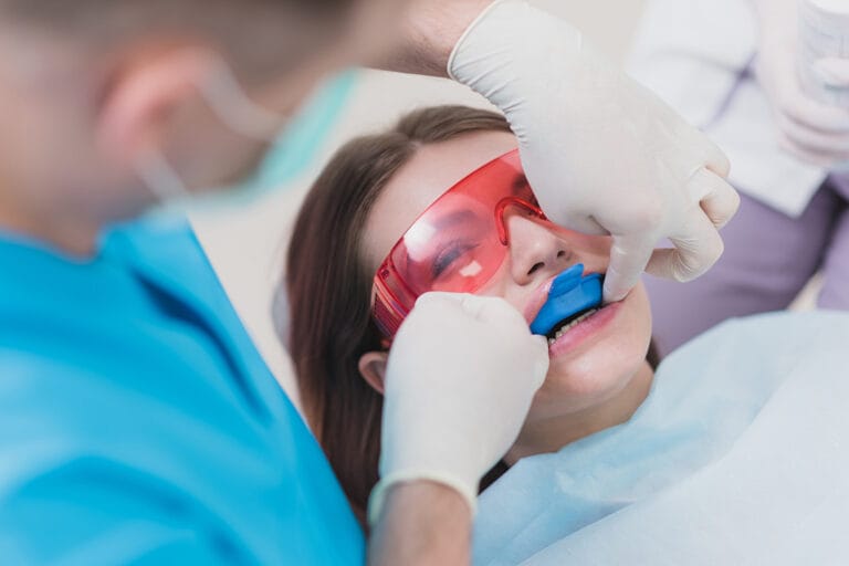 Stannous vs. Sodium Fluoride: When Dental Professionals Should ...