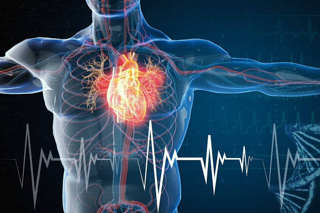 Ten Curious Signs of Cardiovascular Disease - Today's RDH