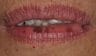 Kiss and Tell: Variations of Normal and Pathology of the Lips - Today's RDH