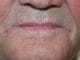 Kiss and Tell: Variations of Normal and Pathology of the Lips - Today's RDH