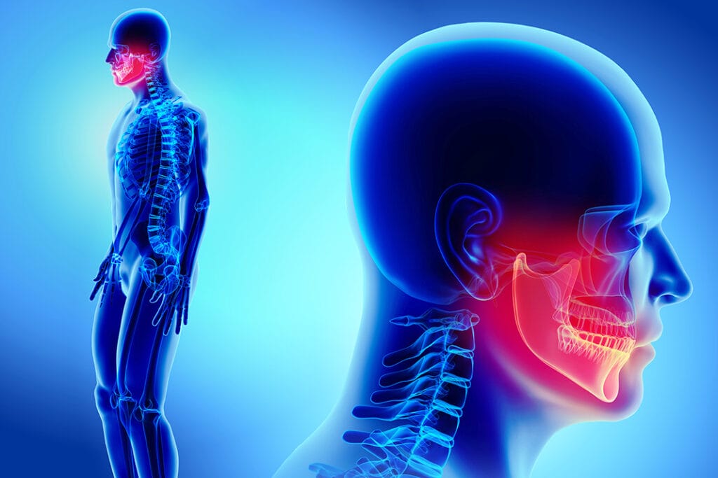 “Osteo” Conditions Overview and Oral Health Implications - Today's RDH