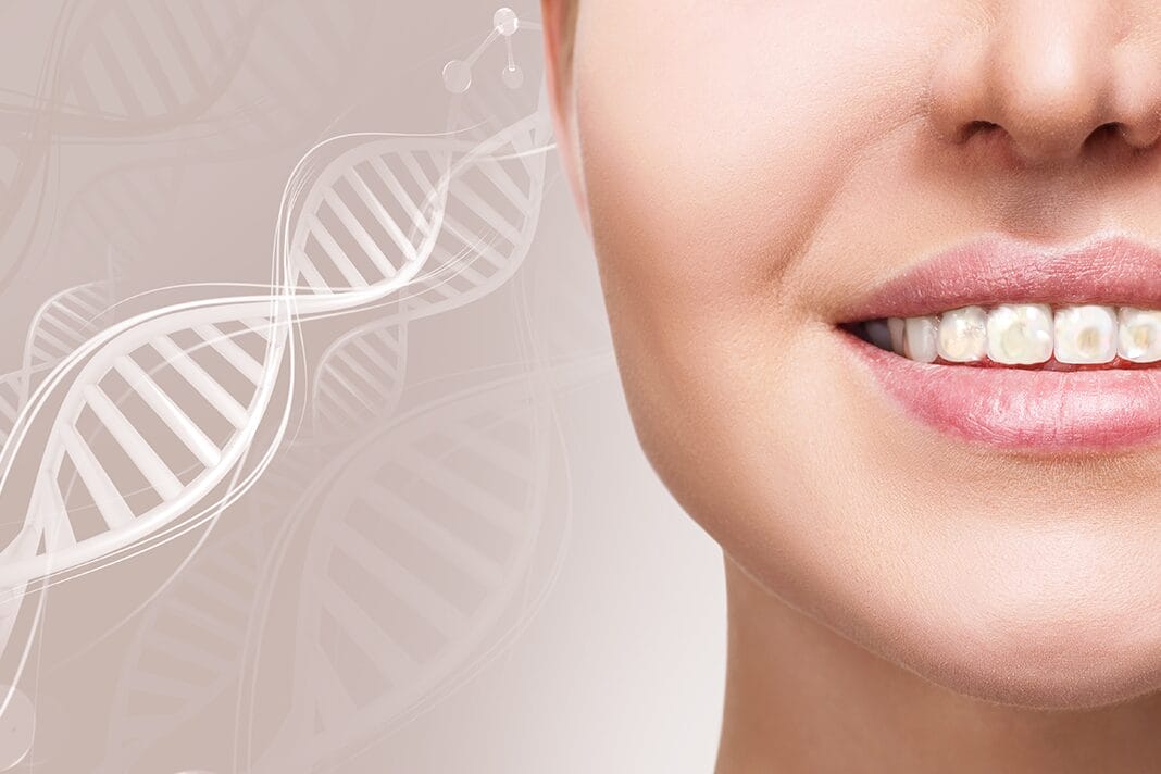 The Mystery of Tooth Enamel Defects: A New Autoimmune Disorder ...