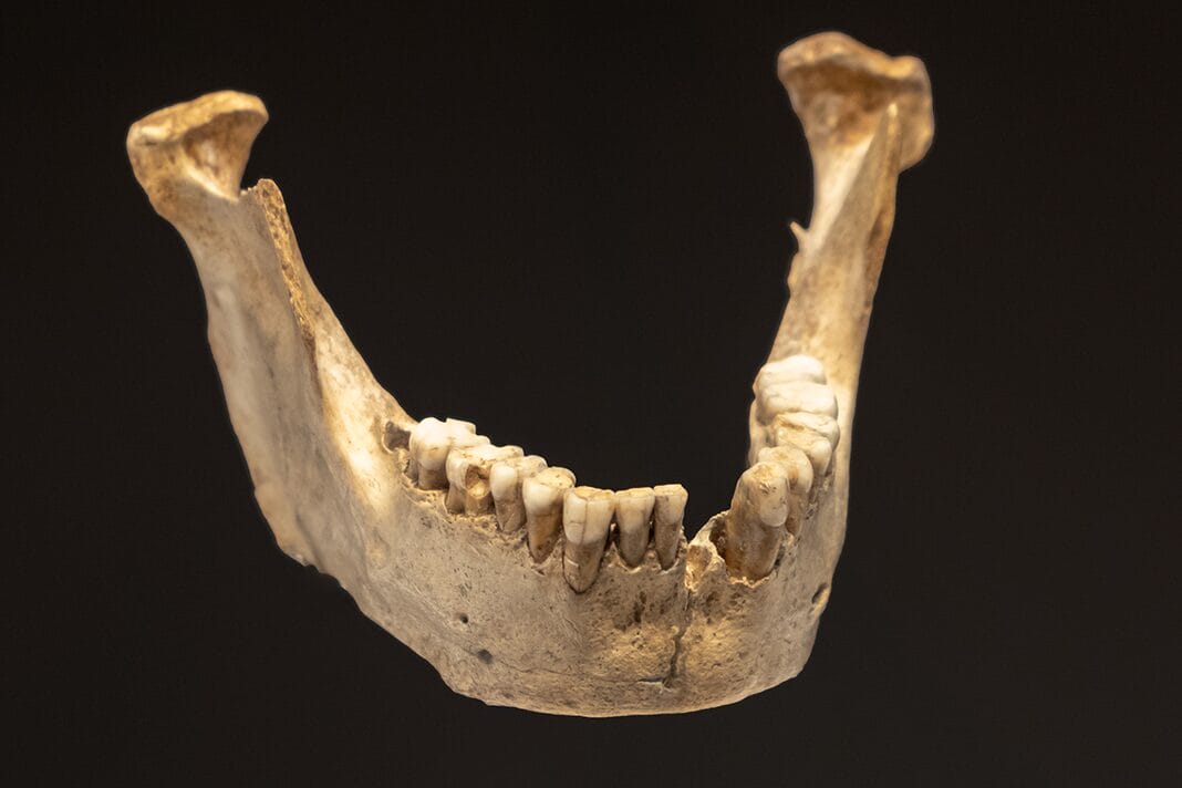 Ancient Teeth Reveal Insights into Evolution of Oral Microbiomes ...