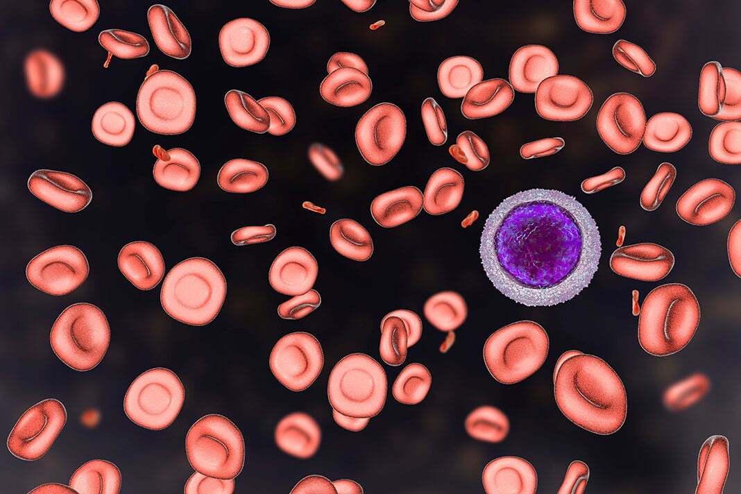 Mastic Gum: Oral Health Benefits Deserve Consideration by Dental ...