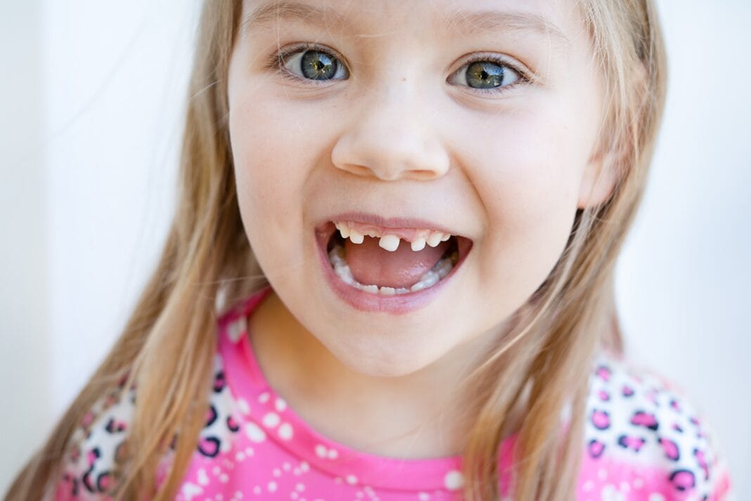 The Mystery of Tooth Enamel Defects: A New Autoimmune Disorder ...